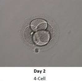 Embryo Development in IVF | Wilcox Fertility