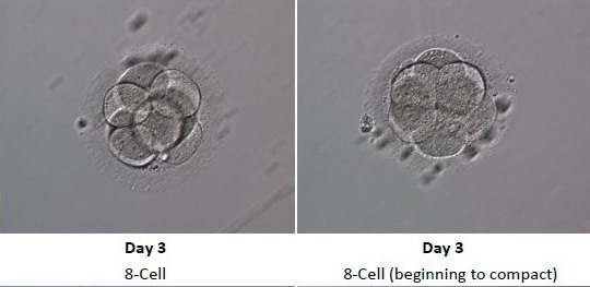 Embryo Development in IVF | Wilcox Fertility